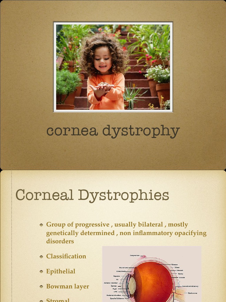 Corneal Dystrophies: Types, Signs, Symptoms, and Treatment | PDF