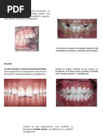 Curva de Spee y Wilson | PDF | Ortodoncia | Odontología