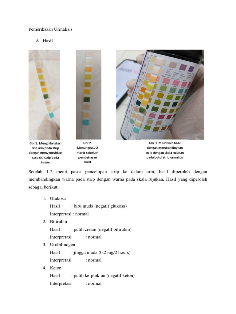 Pemeriksaan Urinalisis | PDF