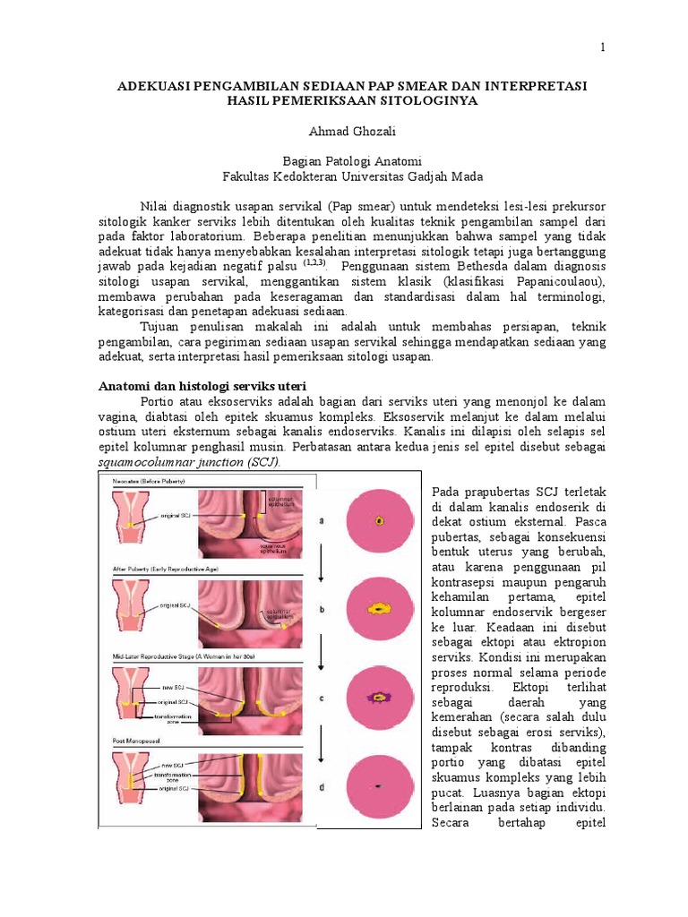 Adekuasi Pengambilan Sediaan Pap Smear Dan Interpretasi Hasil ...
