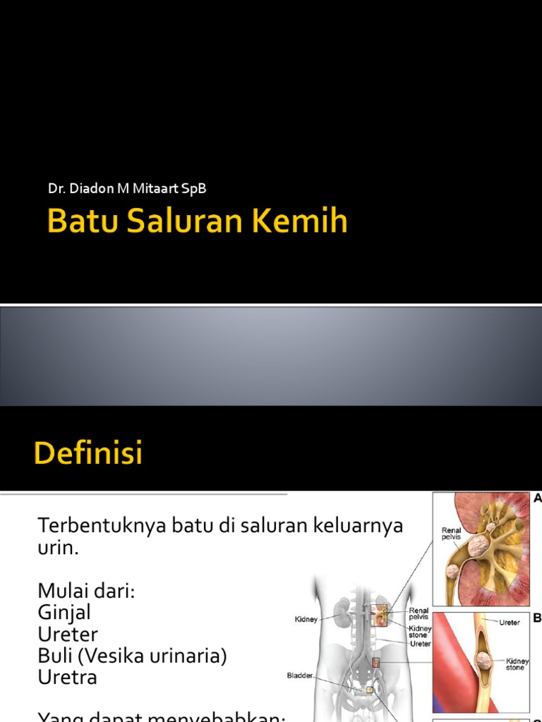 Batu Saluran Kemih | PDF