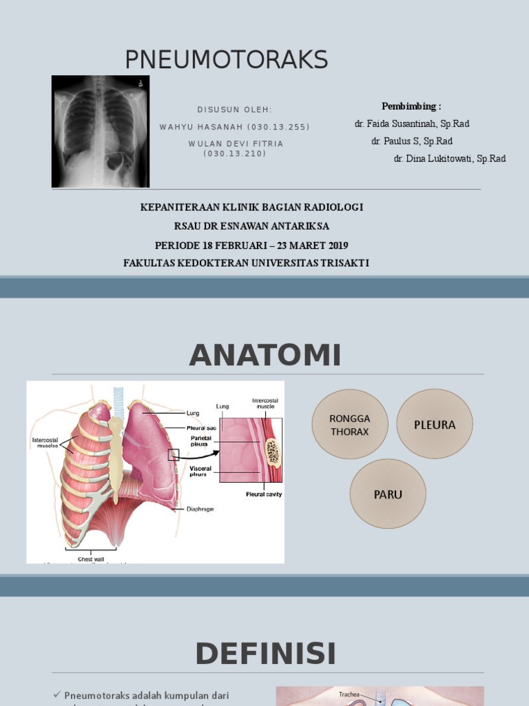 Referat Pneumothorax | PDF