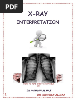 Chest X-Ray Interpretation Guide | PDF | Lung | Thorax