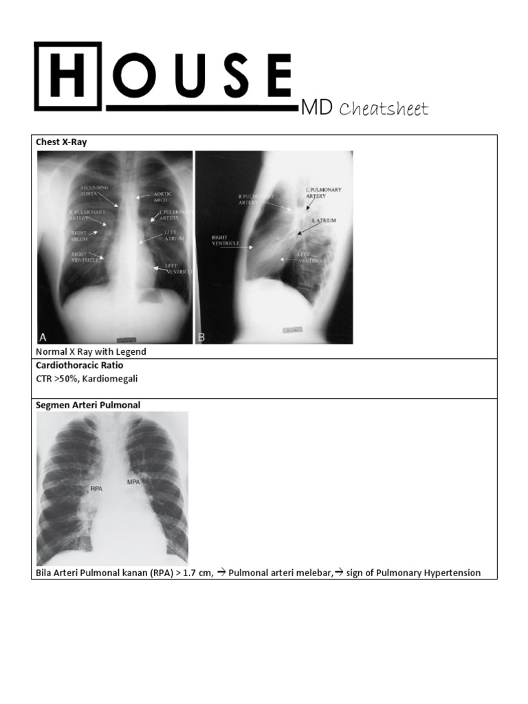 Chest X-Ray | PDF