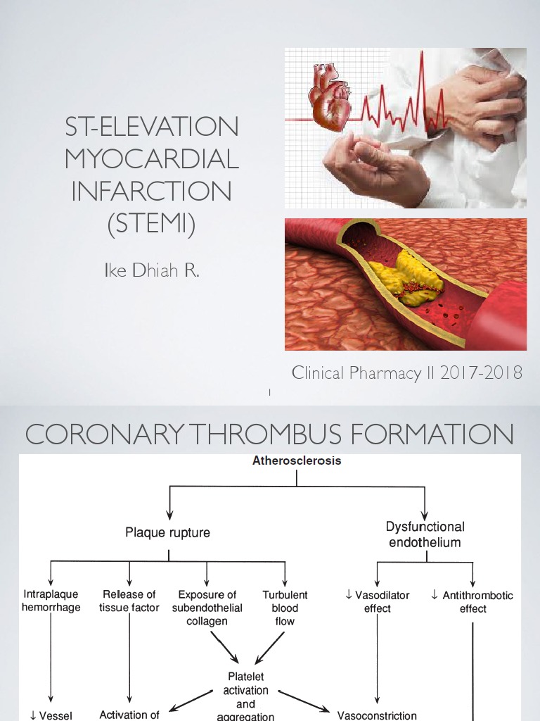 Stemi PDF | PDF | Myocardial Infarction | Cardiac Muscle
