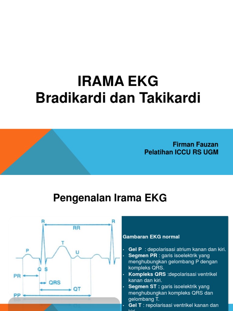 EKG Monitor Bradikardi Dan Takikardi Inhouse Training