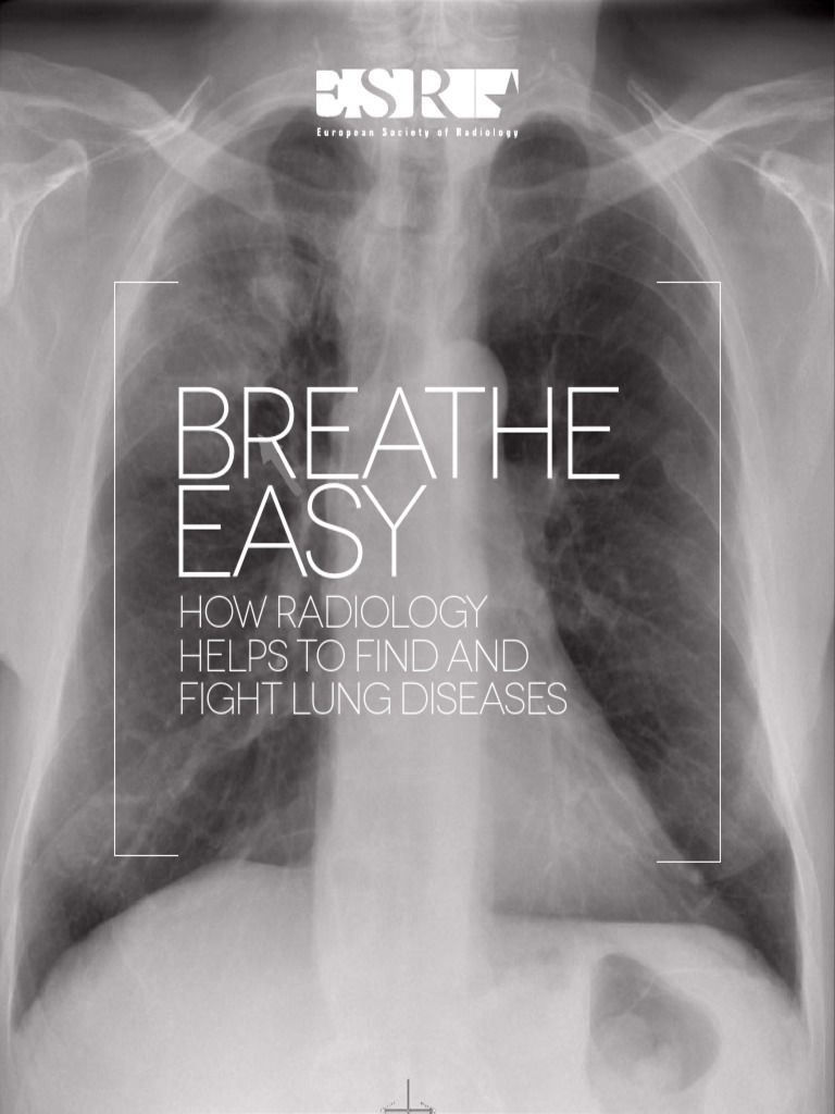 IDOR 2013 ThoracicImaging-Book Breathe-Easy PDF | PDF | Medical Imaging ...