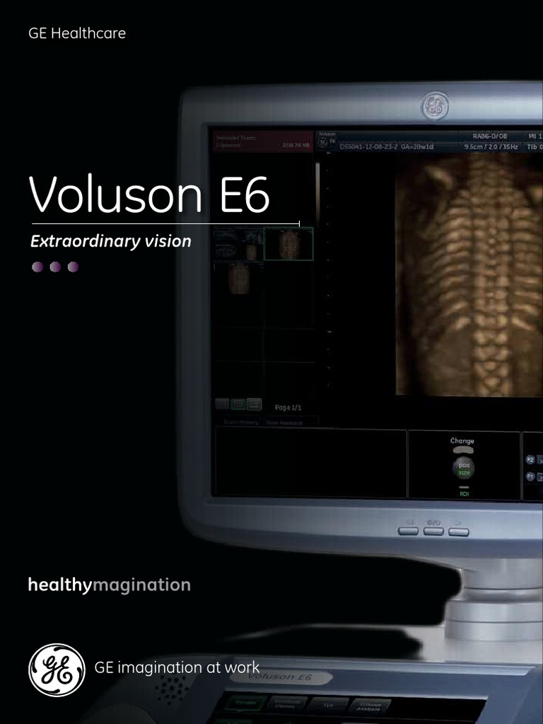 Voluson E6 PDF | PDF | Medical Ultrasound | Health Care