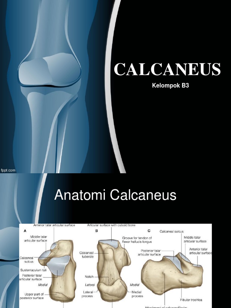 Teknik Pemeriksaan Calcaneus | PDF
