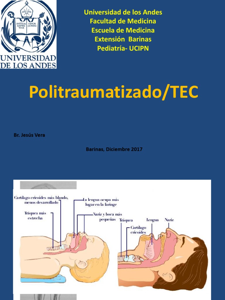 Politraumatizado en Pediatria TEC | Lesión | Neurología