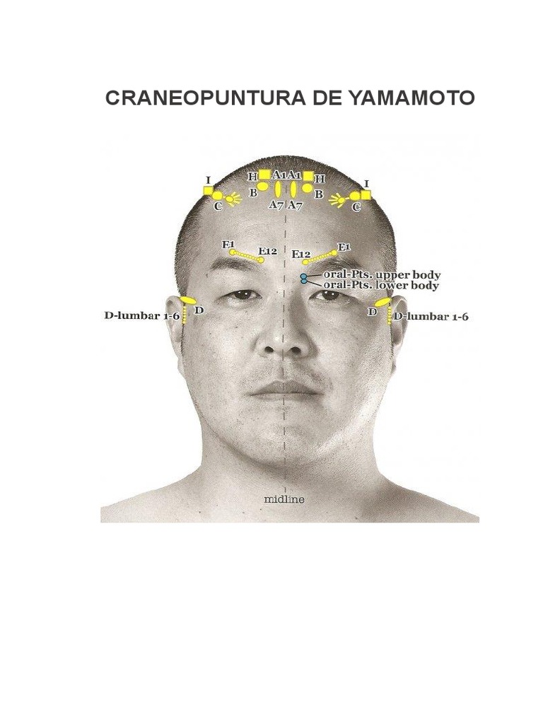 Craneopuntura de Yamamoto | PDF | Hombro | Cerebro