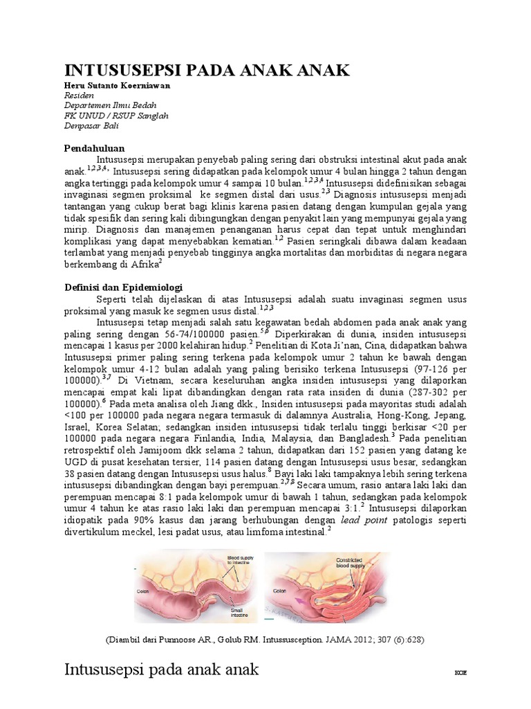 Intususepsi Pada Anak Anak | PDF
