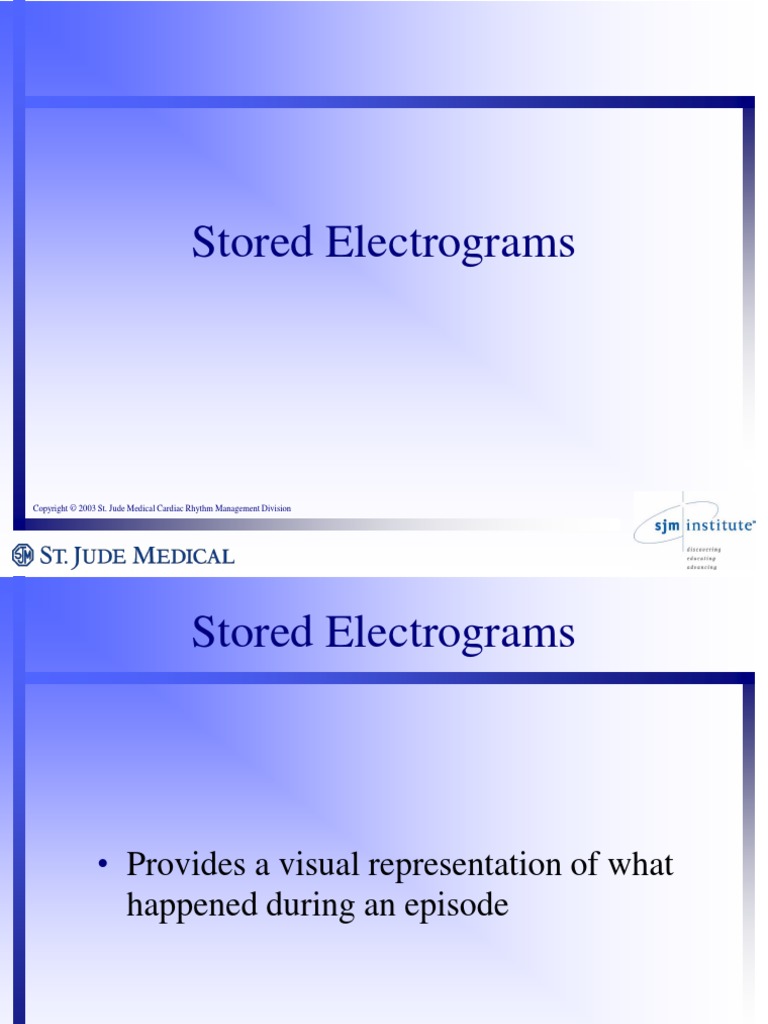 Electrograms | PDF | Electrocardiography | Heart
