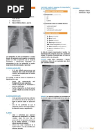 Proyecciones Rx de Tórax: PA y AP | PDF | Tórax (anatomía humana ...