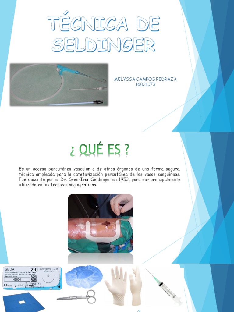 Técnica Seldinger en Cateterización Vascular | PDF