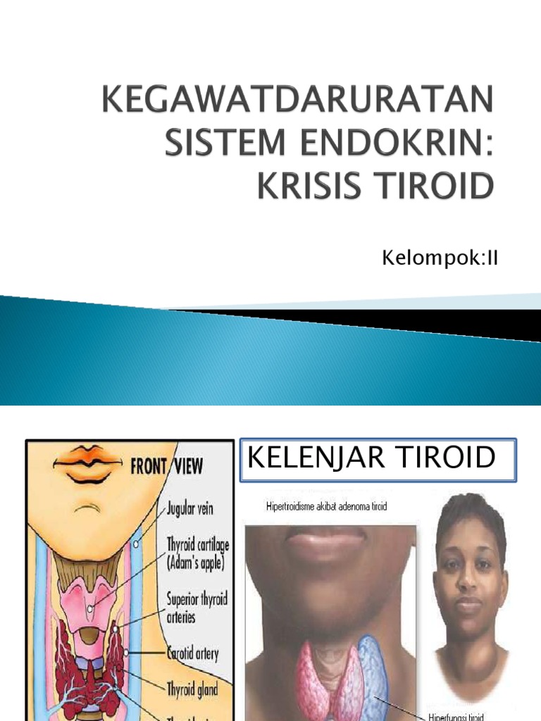 Penanganan Krisis Tiroid dan Tirotoksikosis | PDF