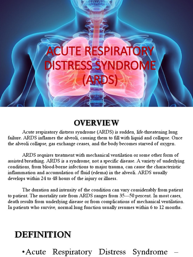 Acute Respiratory Distress Syndrome Ards | PDF