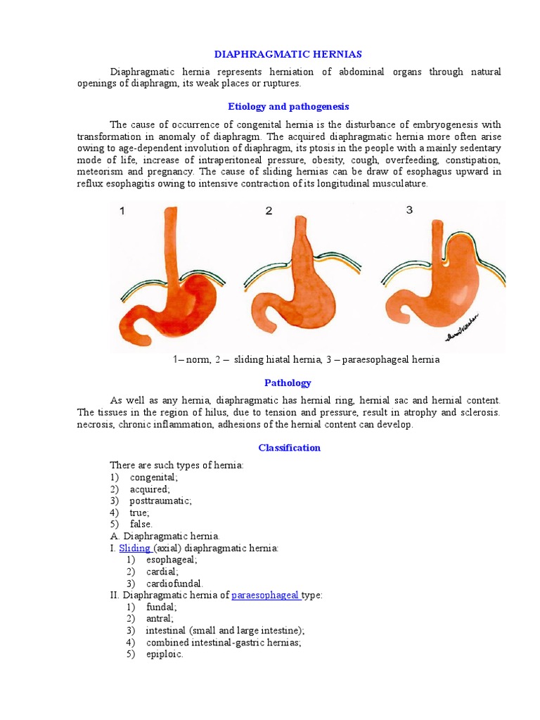 Classification, Symptoms, Complications, Diagnosis and Treatment of Diaphragmatic Hernias | PDF ...