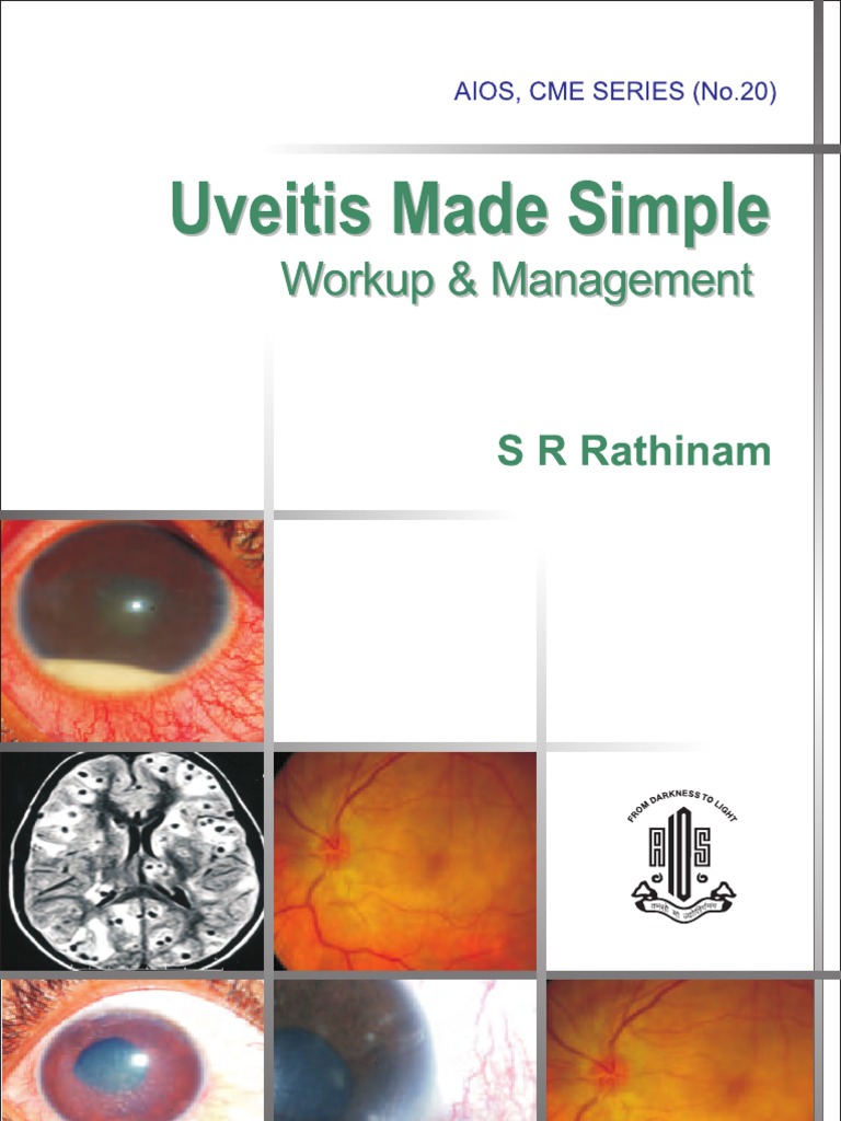 Uveitis Workup | PDF | Glaucoma | Medical Diagnosis