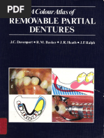 Kennedy Classification 3 | PDF | Prosthodontics | Dentures