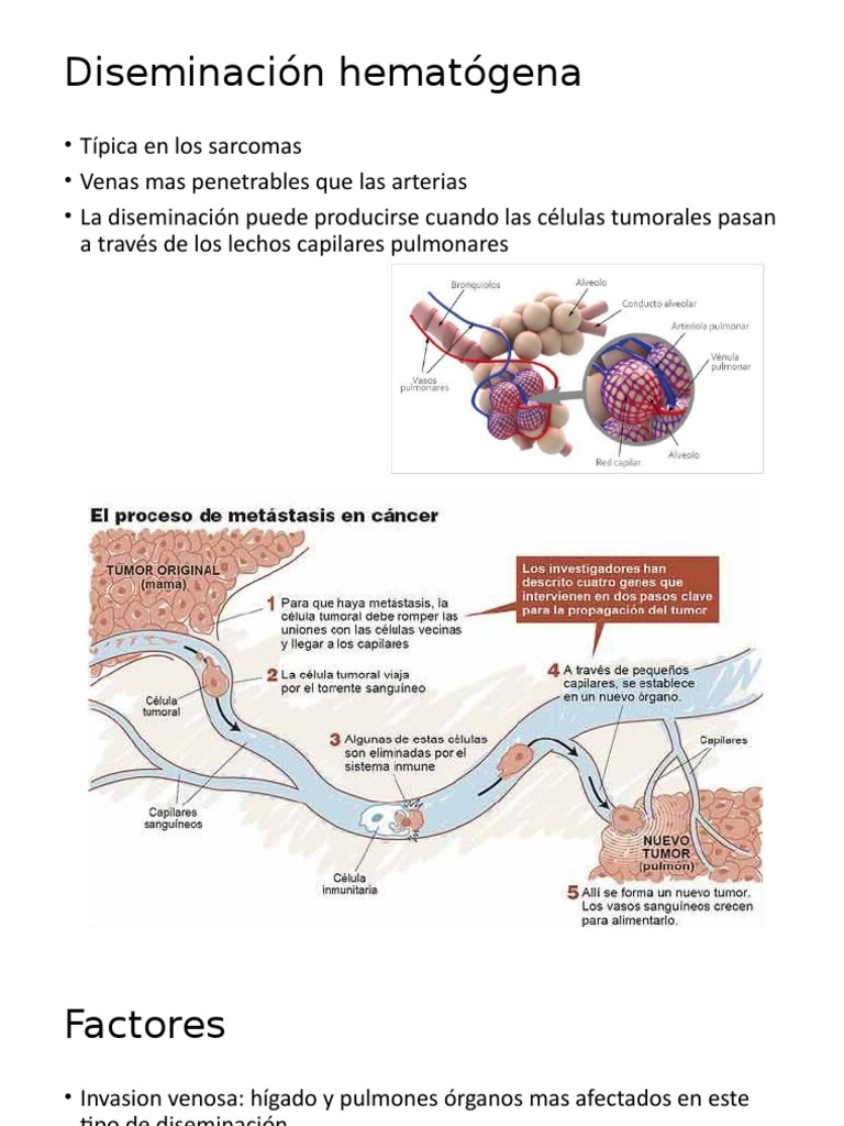 Diseminacion Hematogena | PDF