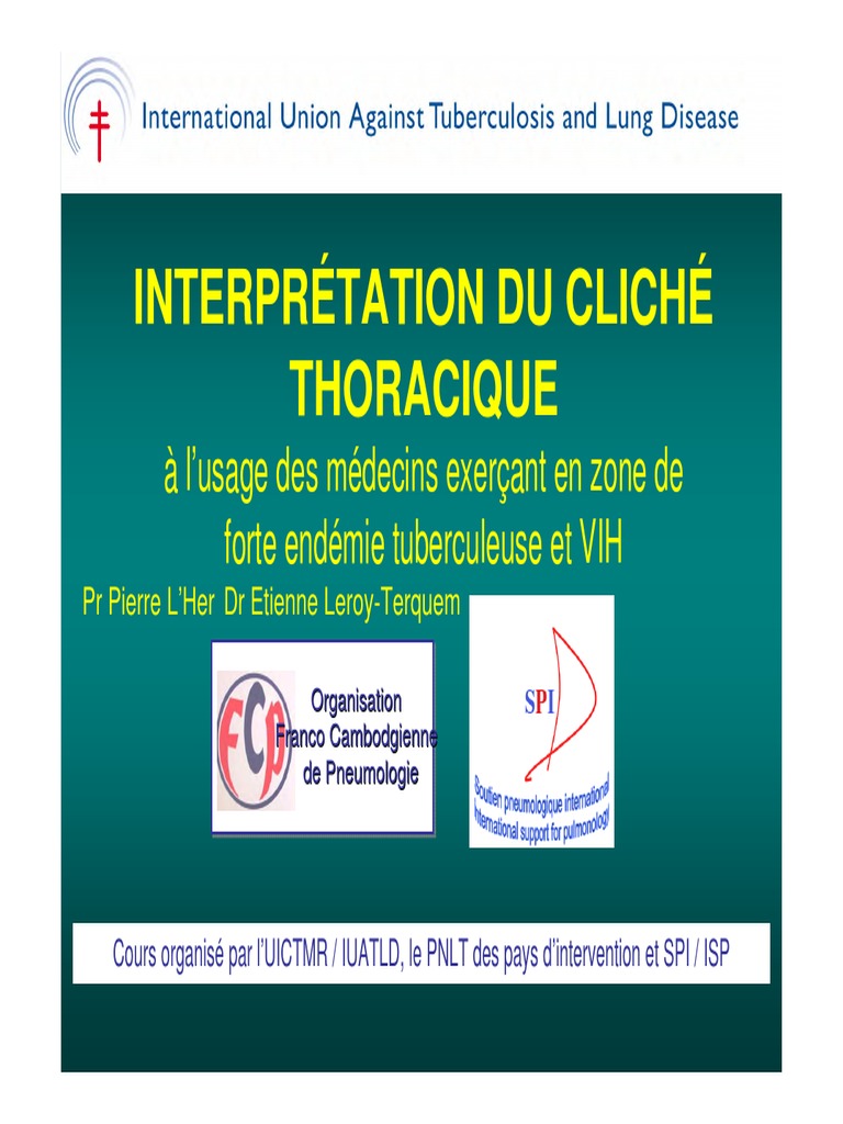 Radio Thorax PDF | PDF | Aorte | Radiographie