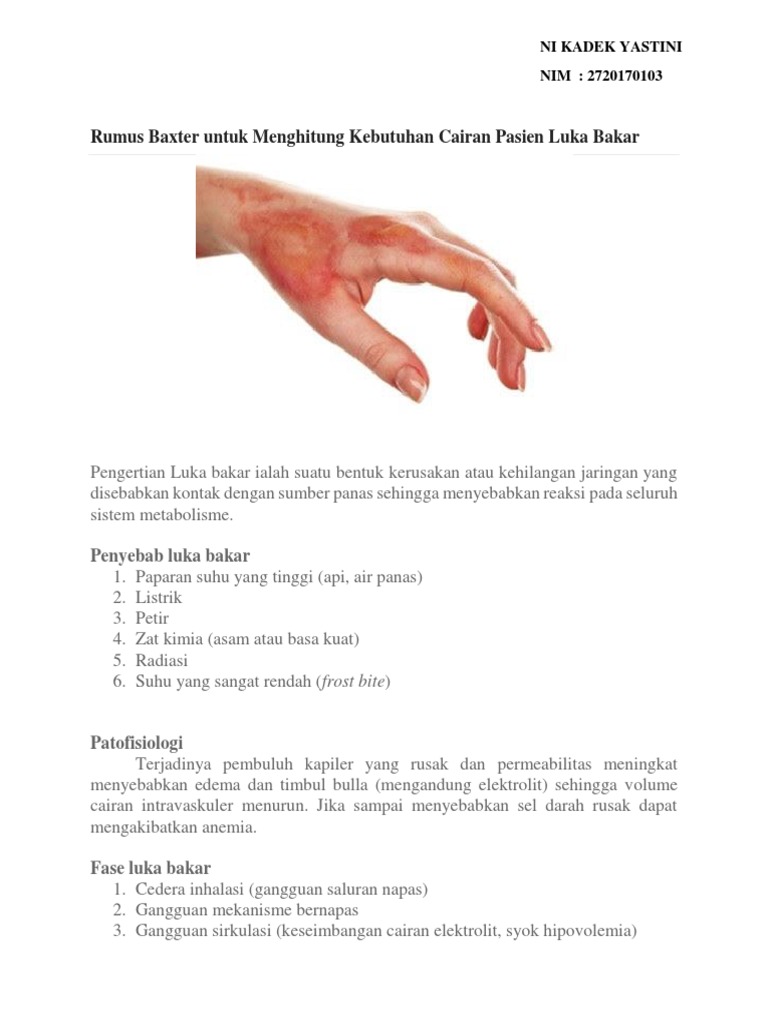 Tugas Rumus Baxter Untuk Menghitung Kebutuhan Cairan Pasien Luka Bakar ...