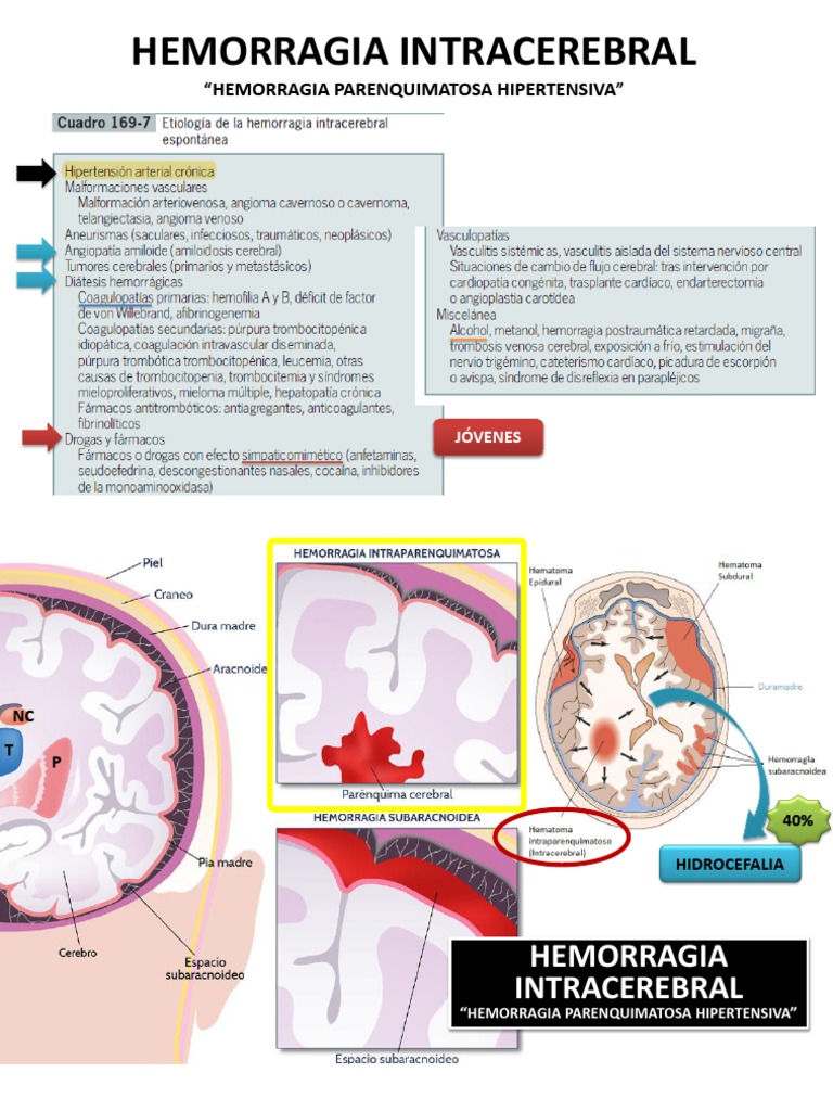 Hemorragia Intracerebral | PDF