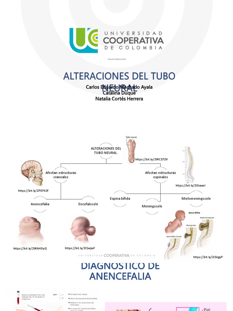Encefalocele y Anencefalia 1 | PDF | Pediatría | Desorden congenito