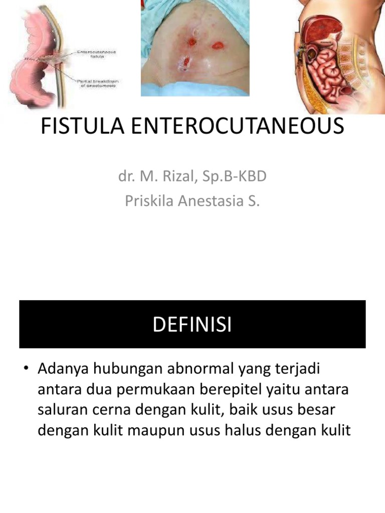 Fistula Enterocutaneous | PDF