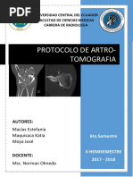 Pitch y TC Helicoidal | PDF | Ct Scan