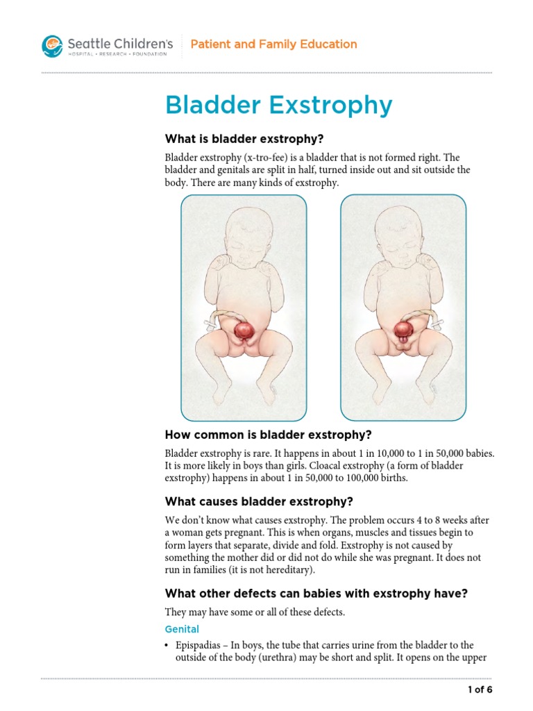 Bladder Exstrophy In Adults