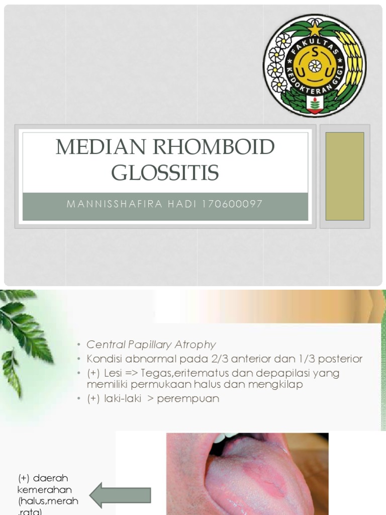 Median Rhomboid Glossitis | PDF