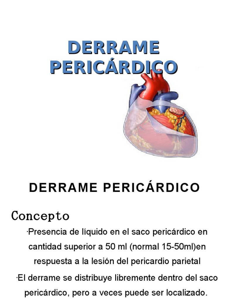 Derrame Pericárdico | PDF