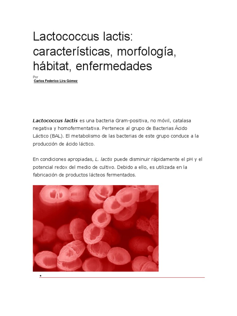 Lactococcus lactis: características y usos | PDF | Productos lácteos ...