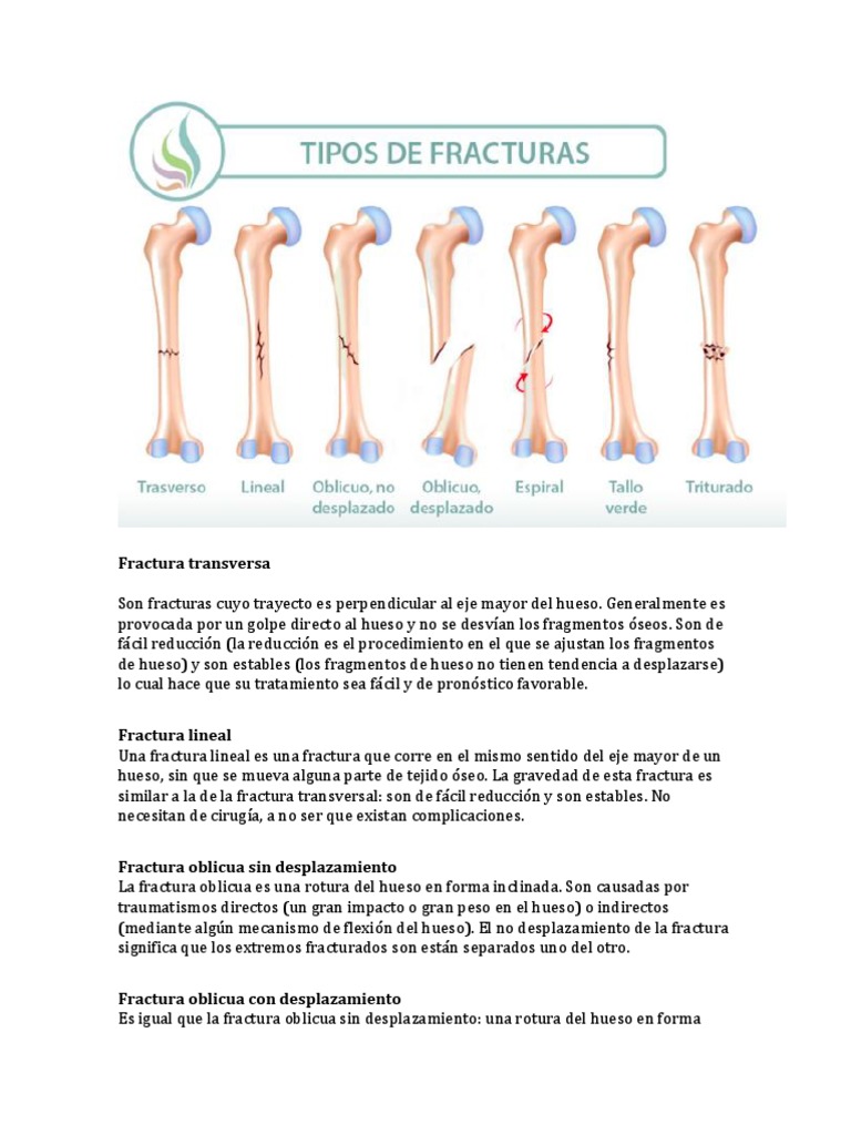 Fractura Transversa | PDF | Hueso | Lesión