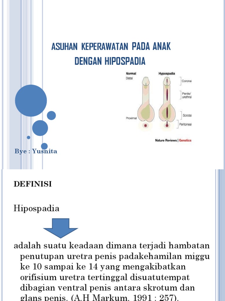 Askep Hipospadia Pada Anak | PDF
