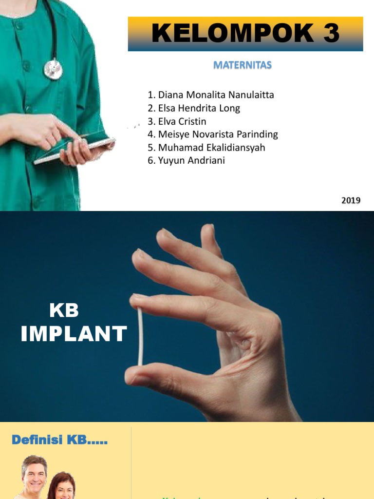 Maternitas KB Implan Kel 3 | PDF