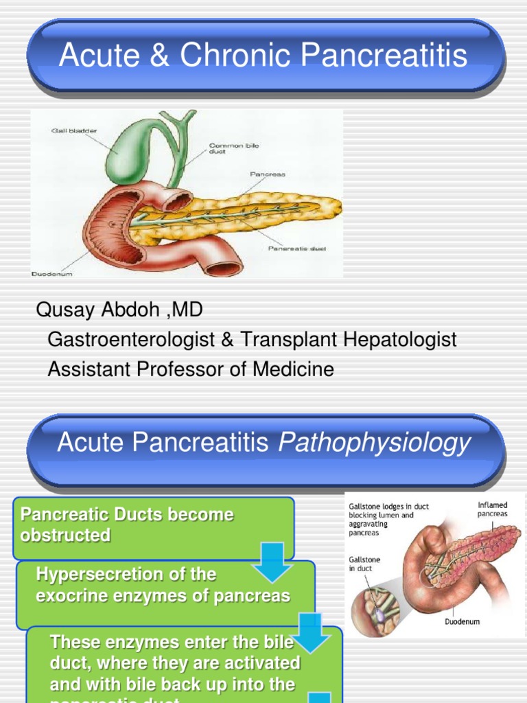 Acute & Chronic Pancreatitis | PDF | Pancreas | Gastroenterology