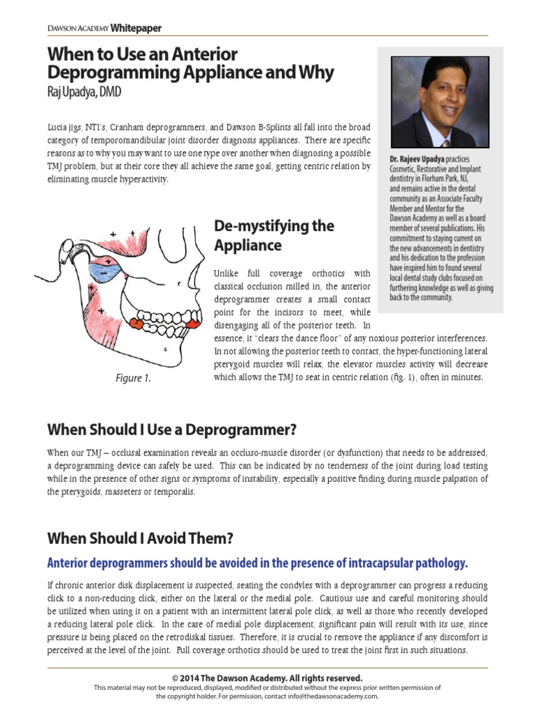 When To Use Deprogramming Splint and Why | PDF | Mouth | Health Sciences
