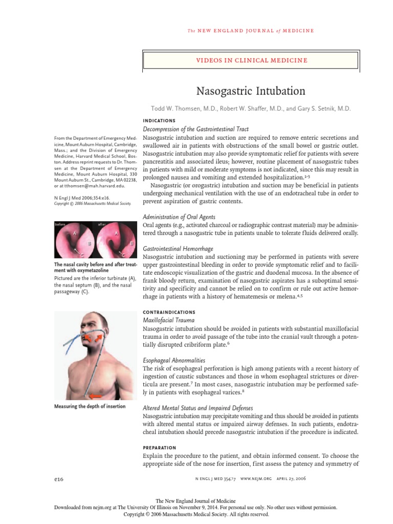 NGT Intubation NEJM | PDF | Medical Specialties | Respiratory System