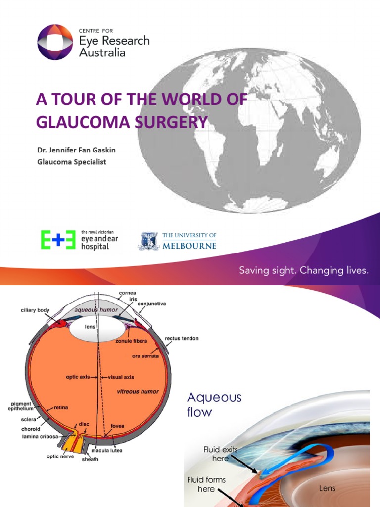 A Tour of The World of Glaucoma Surgery: Dr. Jennifer Fan Gaskin ...