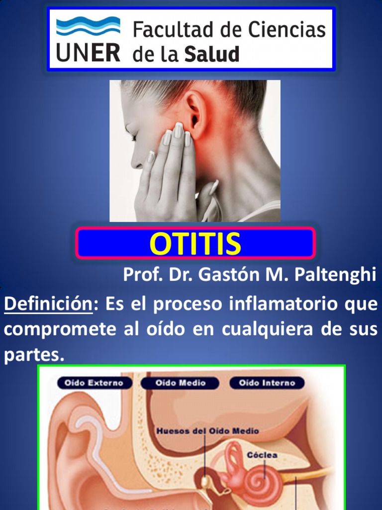Clasificación y Tratamiento de Otitis | PDF | Medicina CLINICA ...