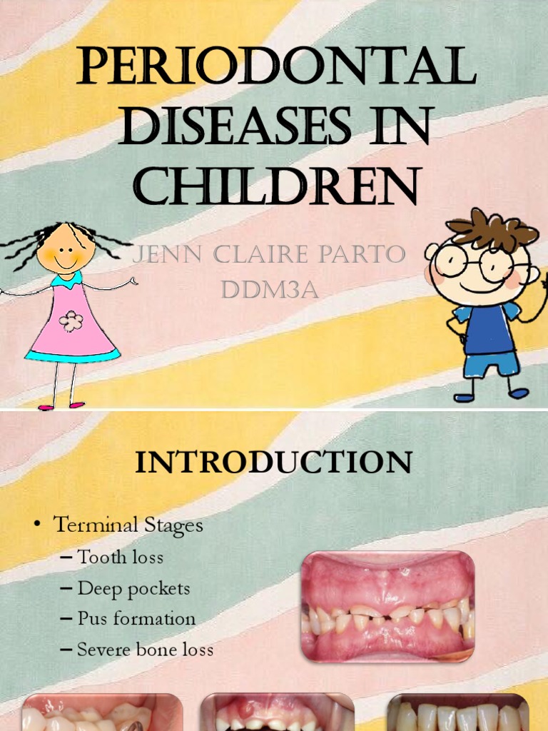 Periodontal Diseases in Children | PDF | Oral Hygiene | Periodontology
