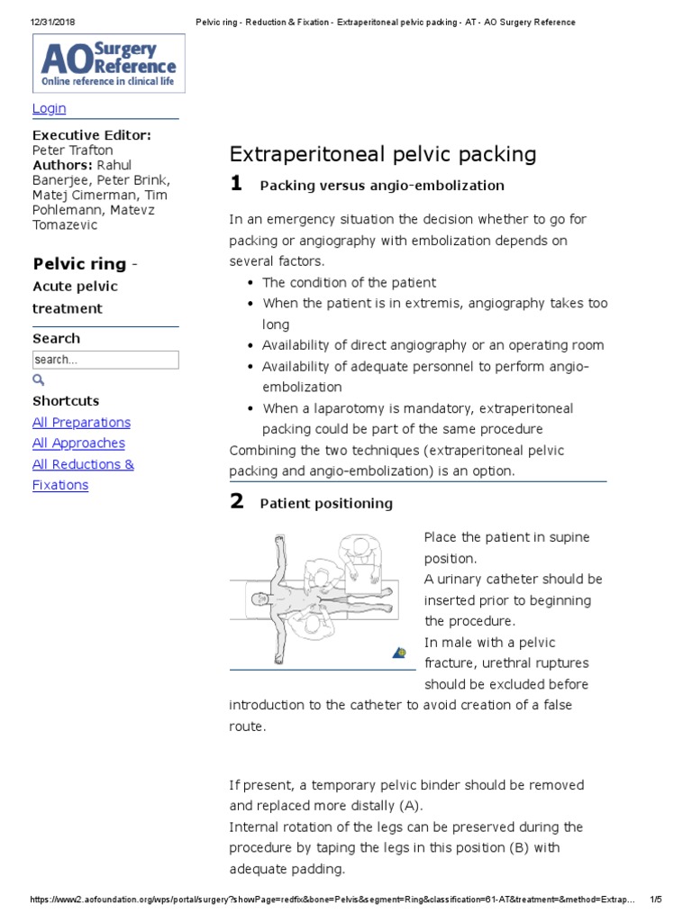 Pelvic Ring - Reduction & Fixation - Extraperitoneal Pelvic Packing ...
