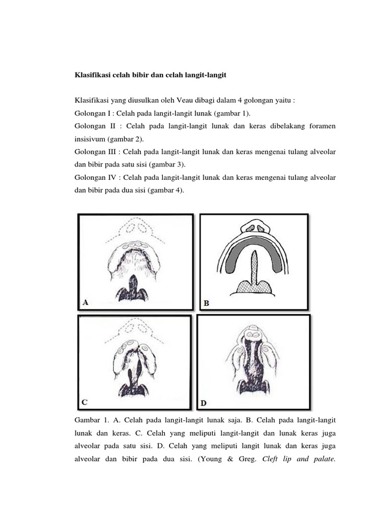 Klasifikasi Cleft | PDF