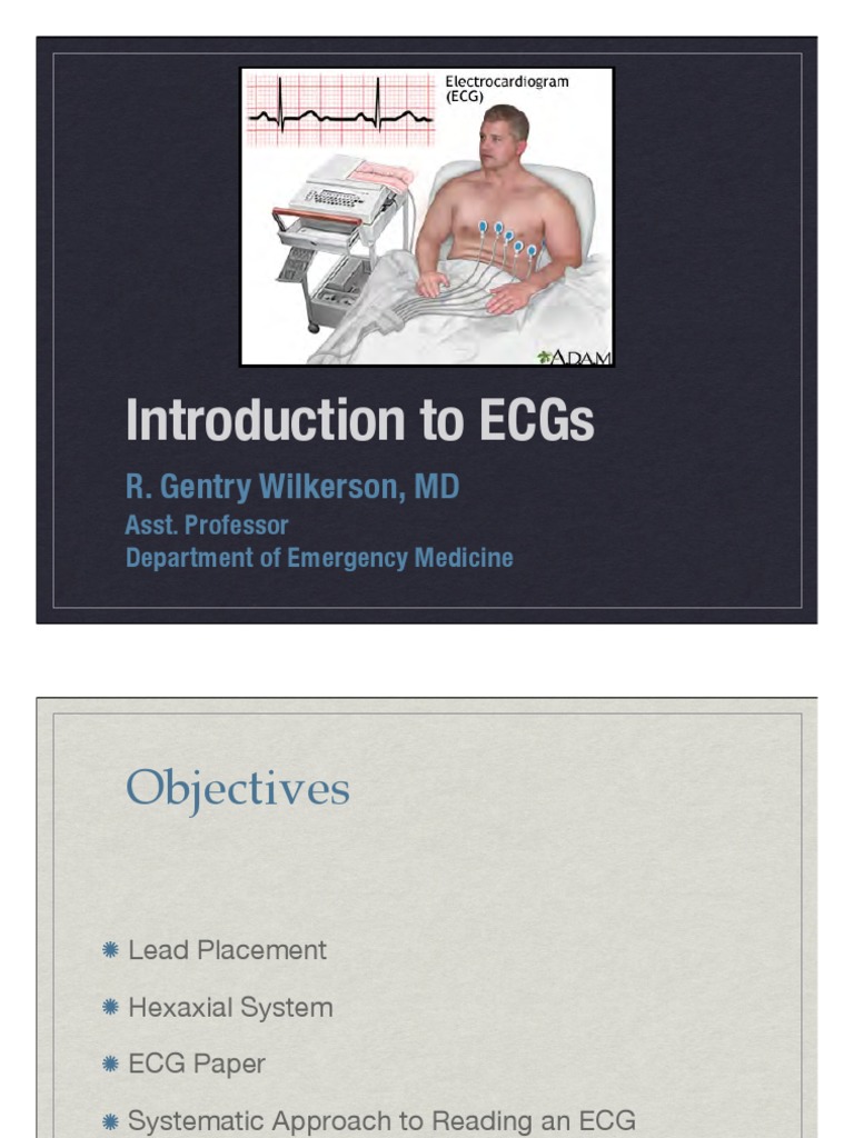 Powerpoint Presentation of The Basics of EKGs From R Gentry Wilkerson ...