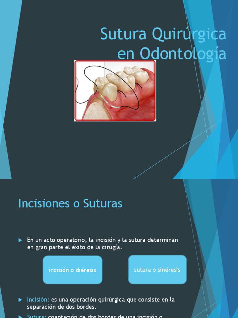 Presentación SUTURA | PDF | Sutura Quirúrgica | Cirugía