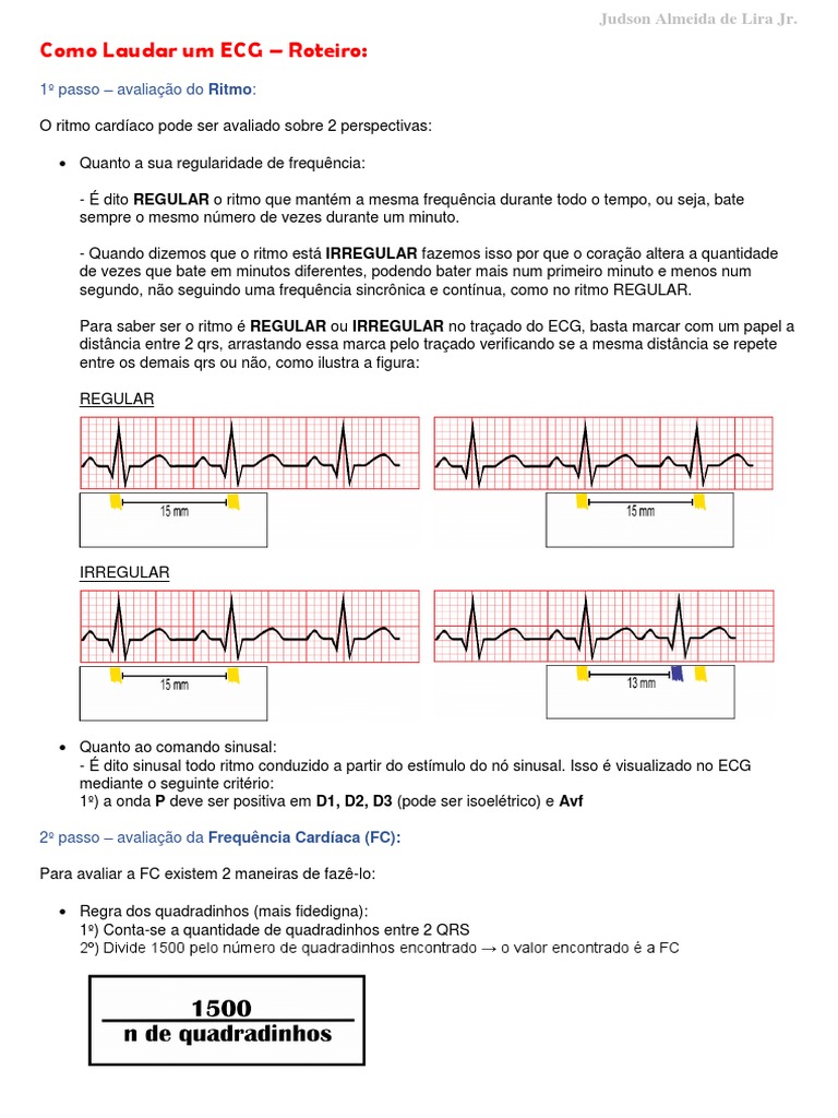 Como Laudar um ECG.docx | Eletrocardiografia | Tórax (Anatomia Humana)