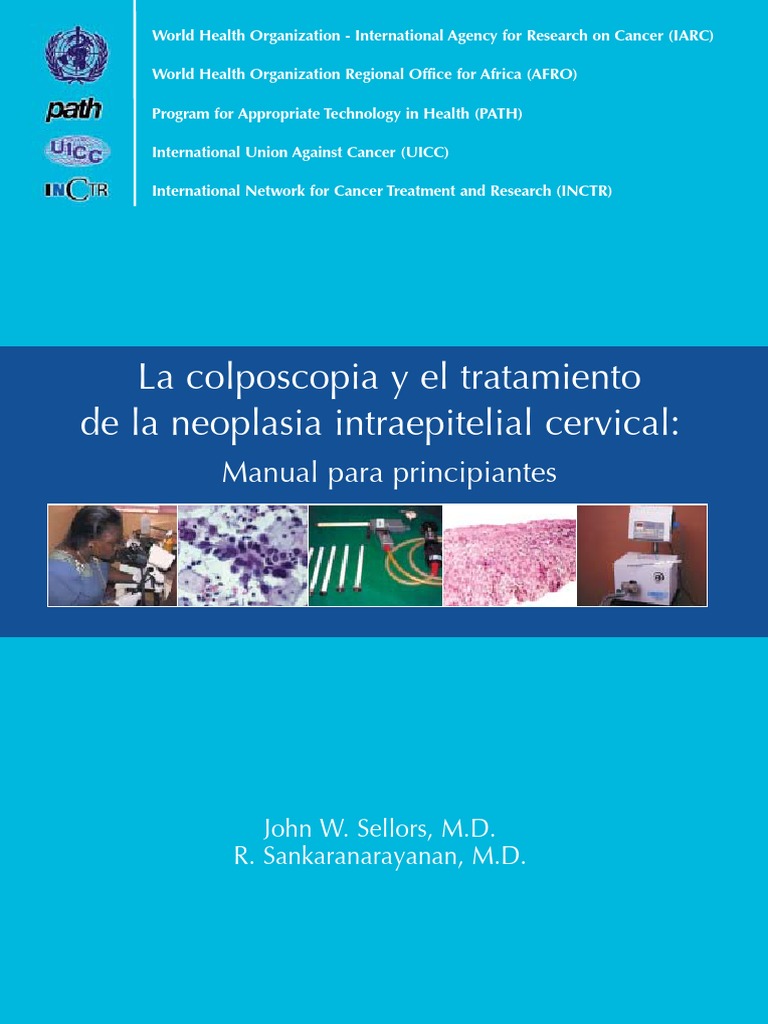 La Colposcopia y El Tratamiento de La Neoplasia Intraepitelial Cervical ...